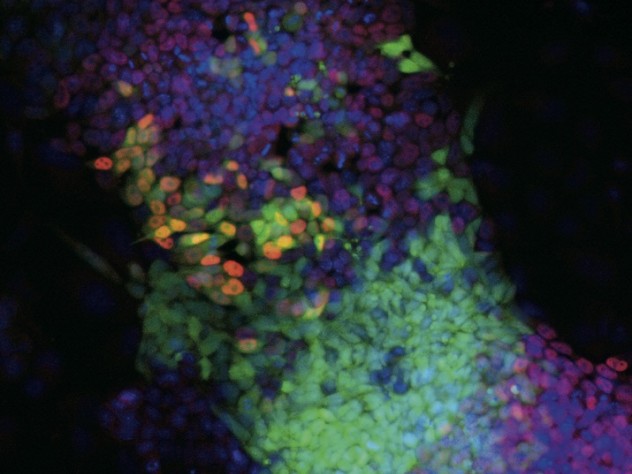 Stem-cell science evolves | Harvard Magazine